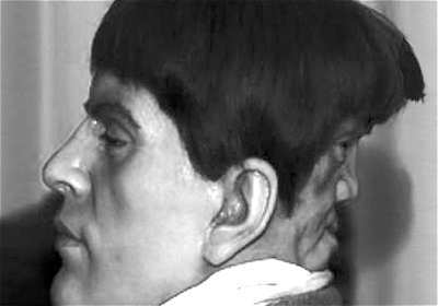The true story of Edward Mordake, the man with two faces - Emadion